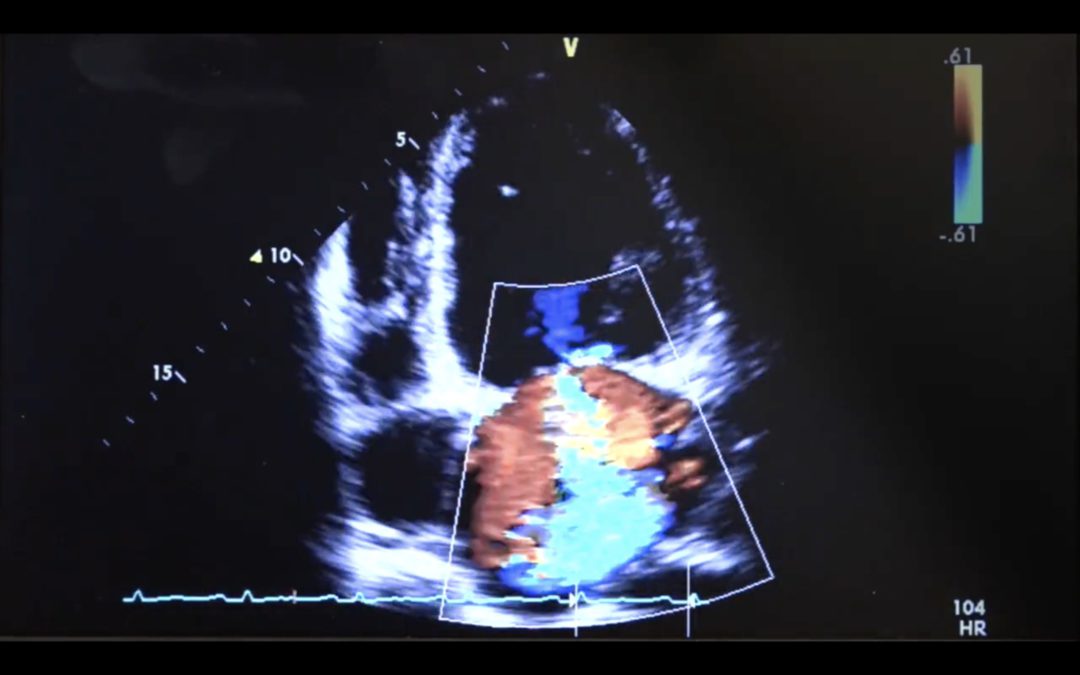European Diploma in Advanced Critical Care Echocardiography (EDEC ...